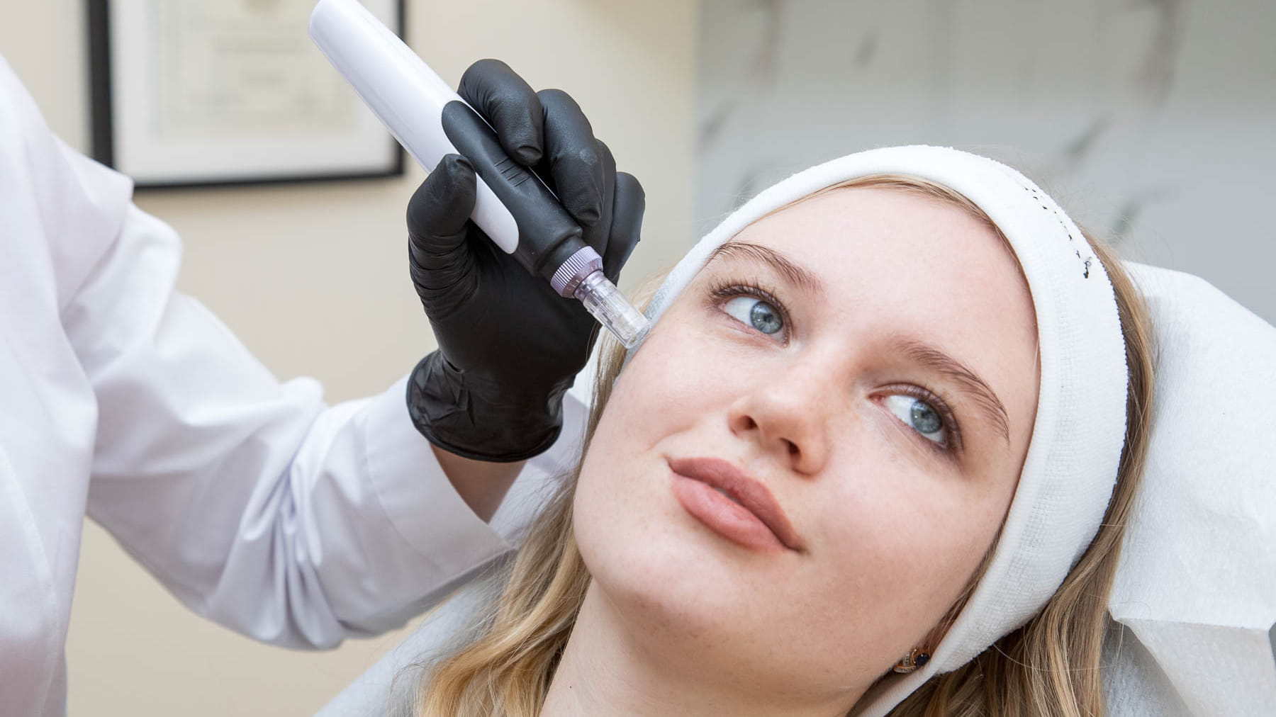 Microneedling | Cosmetic Derma Medicine